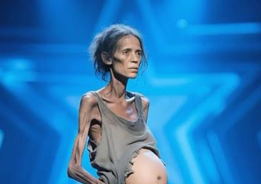 The Ballet of Darkness: How a Delicate Soul Transformed Suffering into ...